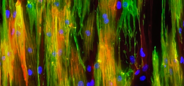 Tissue Engineering | Materials and Biomaterials Science and Engineering
